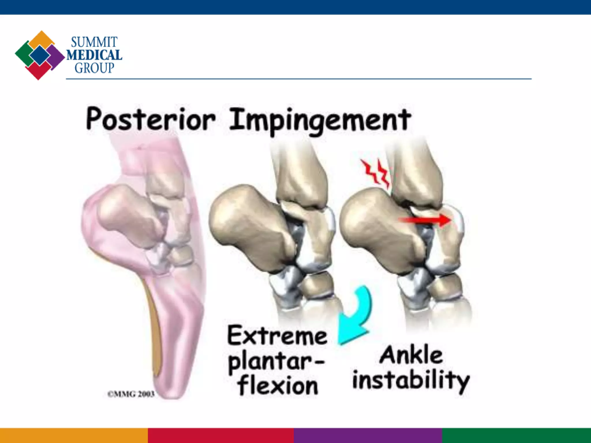 Ankle and Foot Injuries for Athletes - Dr. Andre Ross - Livingston ...