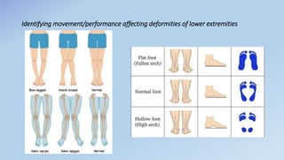 Sports medicine, physiotherapy and rehabilitation.pptx