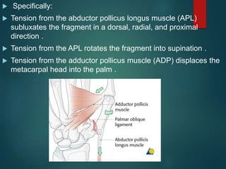 Sports related injuries to hand sagar | PPTX