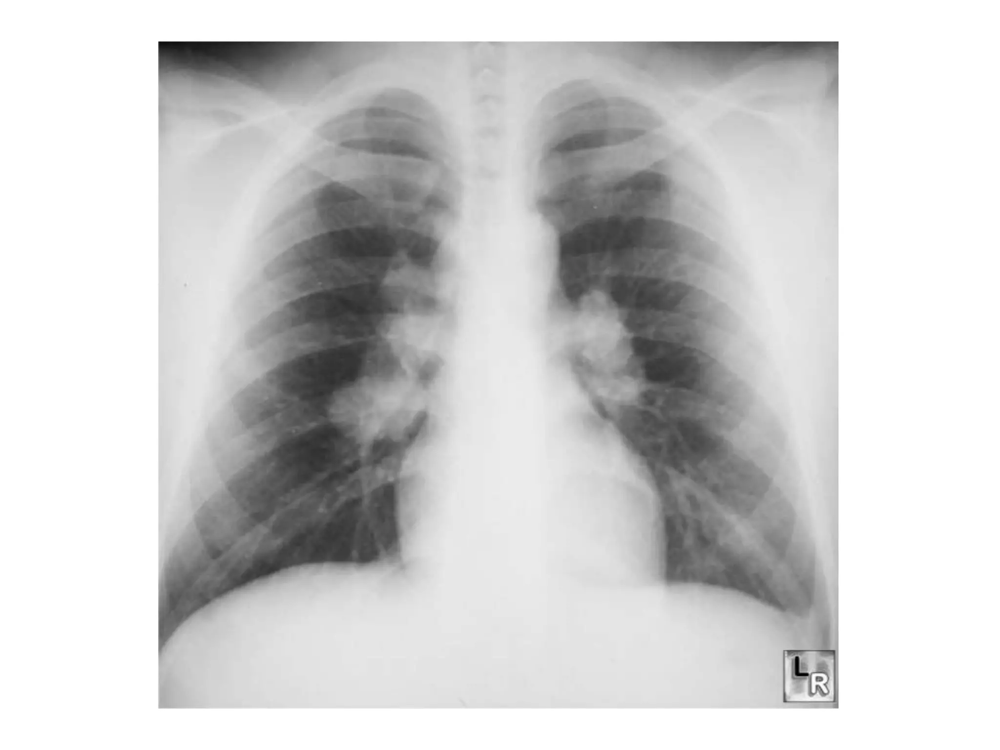 Spot diagnosis for radiology second master degree | PPTX | Digestive ...