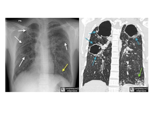 Spot diagnosis for radiology second master degree | PPTX | Digestive ...