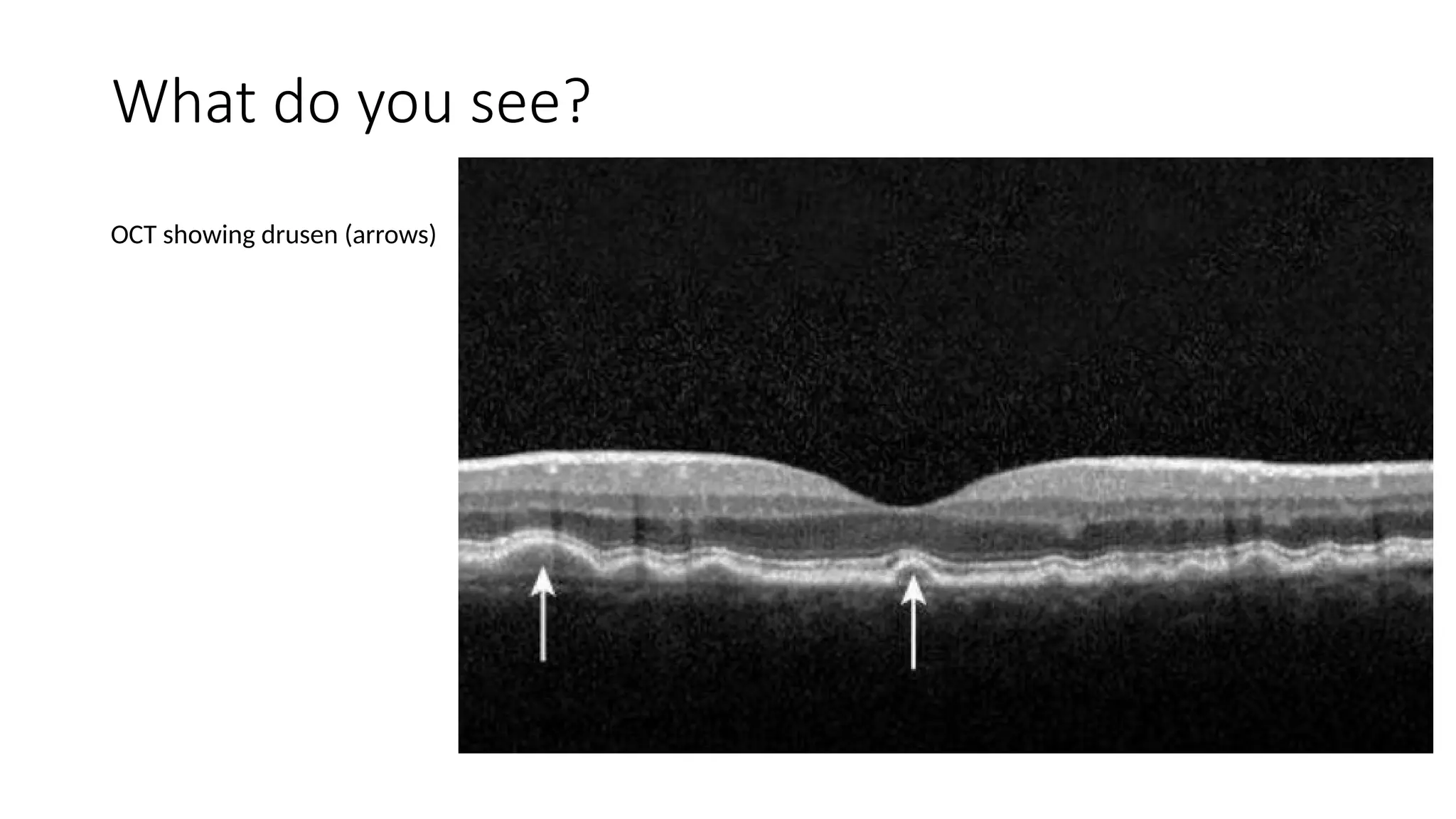 Spot Diagnosis - Look at the pictures-What do you See - Acquired ...