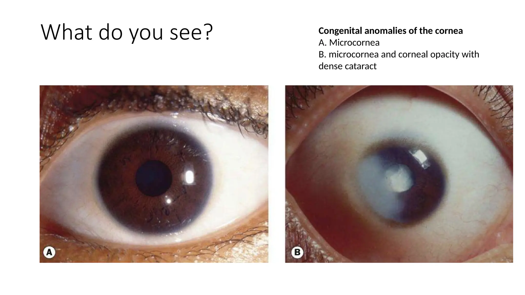 Spot Diagnosis - Look at the pictures-What do you See - Cornea.pptx