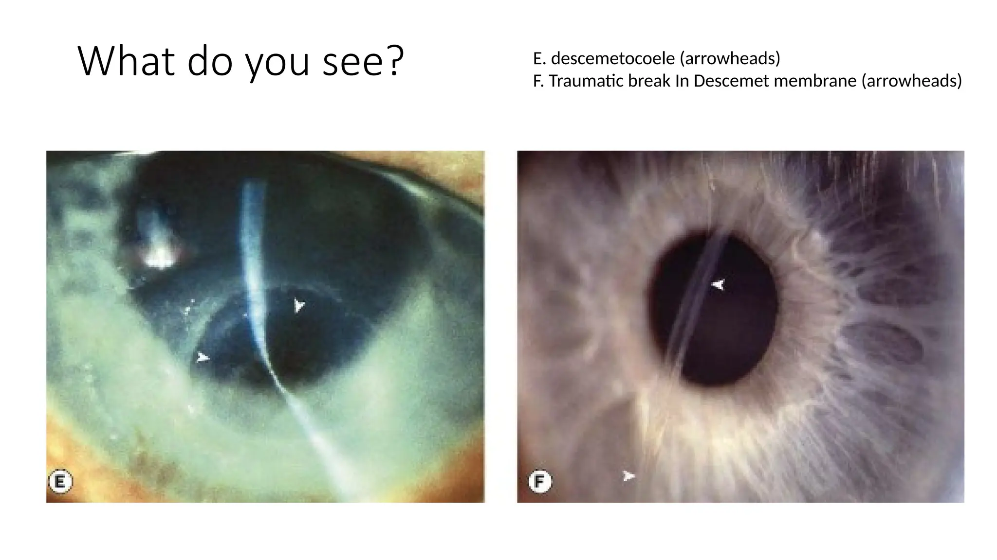 Spot Diagnosis - Look at the pictures-What do you See - Cornea.pptx