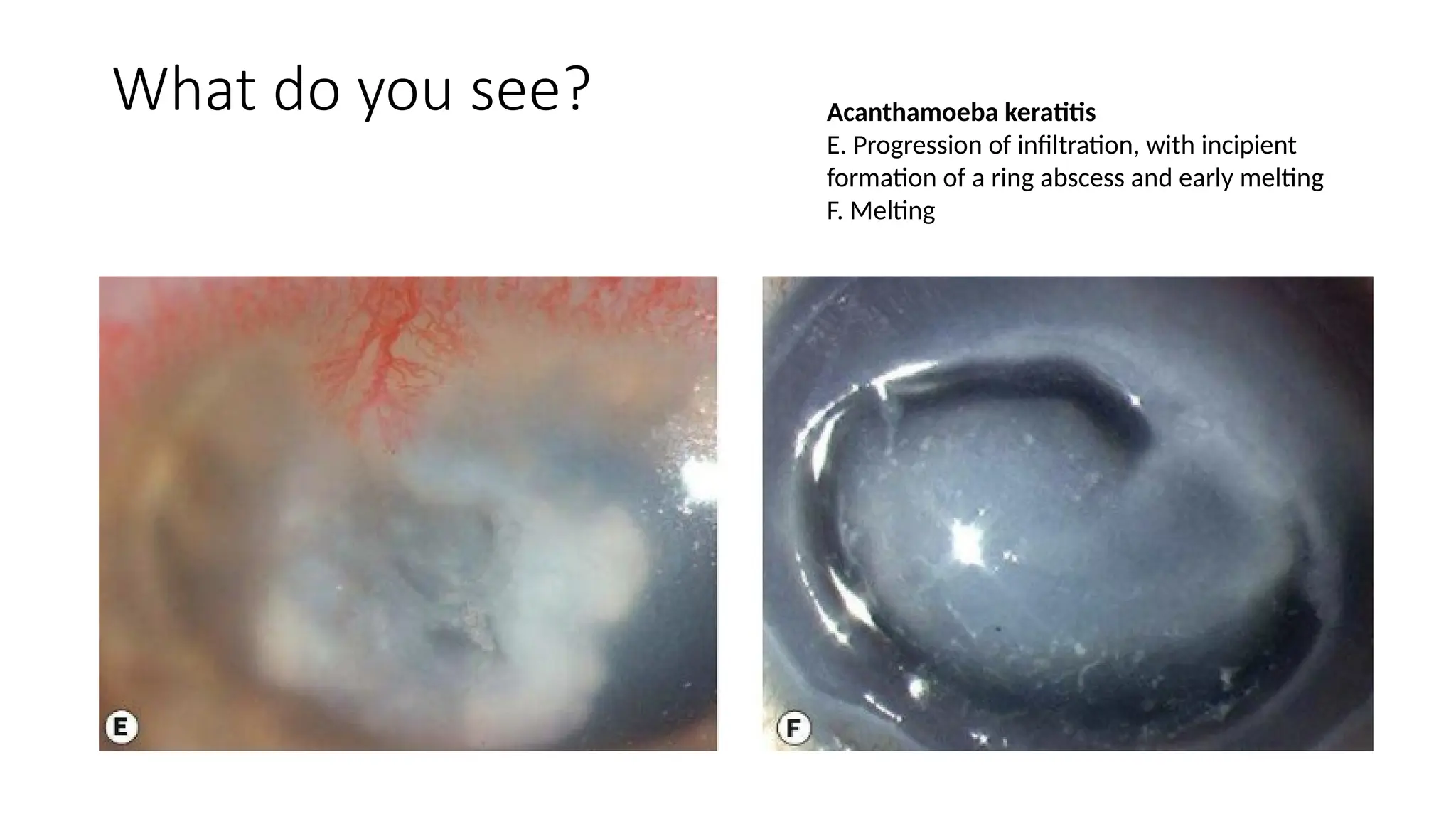Spot Diagnosis - Look at the pictures-What do you See - Cornea.pptx
