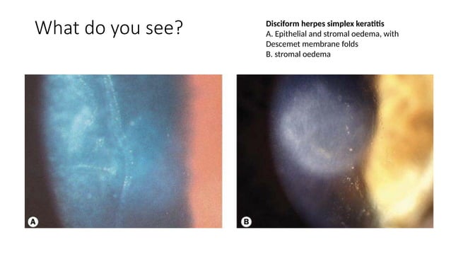 Spot Diagnosis - Look at the pictures-What do you See - Cornea.pptx