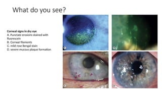 Spot Diagnosis - Look at the pictures-What do you See - Dry Eye.pptx