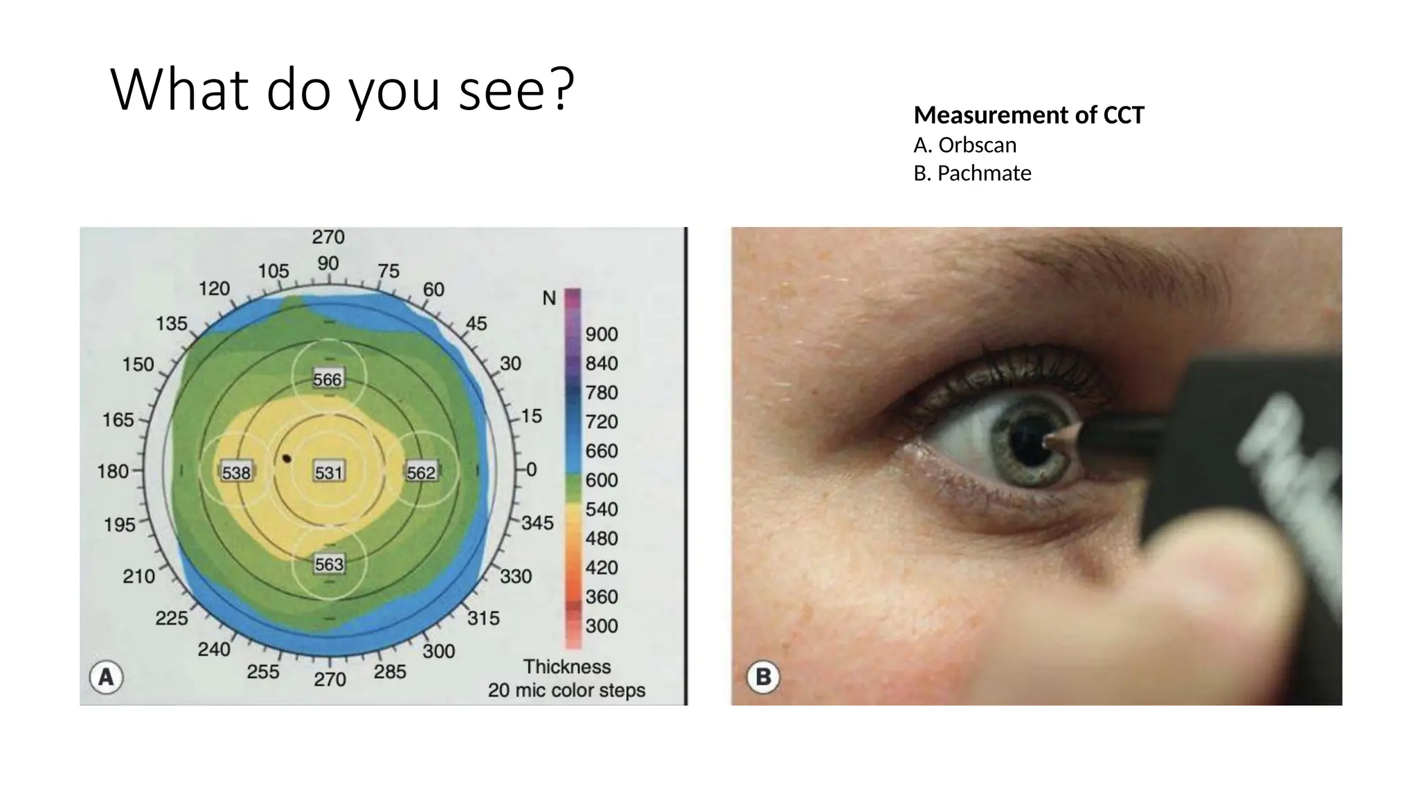 Spot Diagnosis - Look at the pictures-What do you See - Glaucoma.pptx