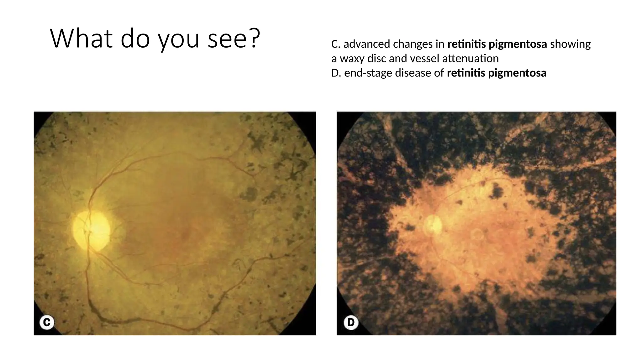 Spot Diagnosis - Look at the pictures-What do you See - Inhereted ...