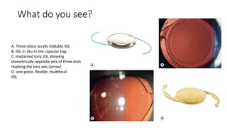 Spot Diagnosis - Look at the pictures-What do you See - Lens.pptx