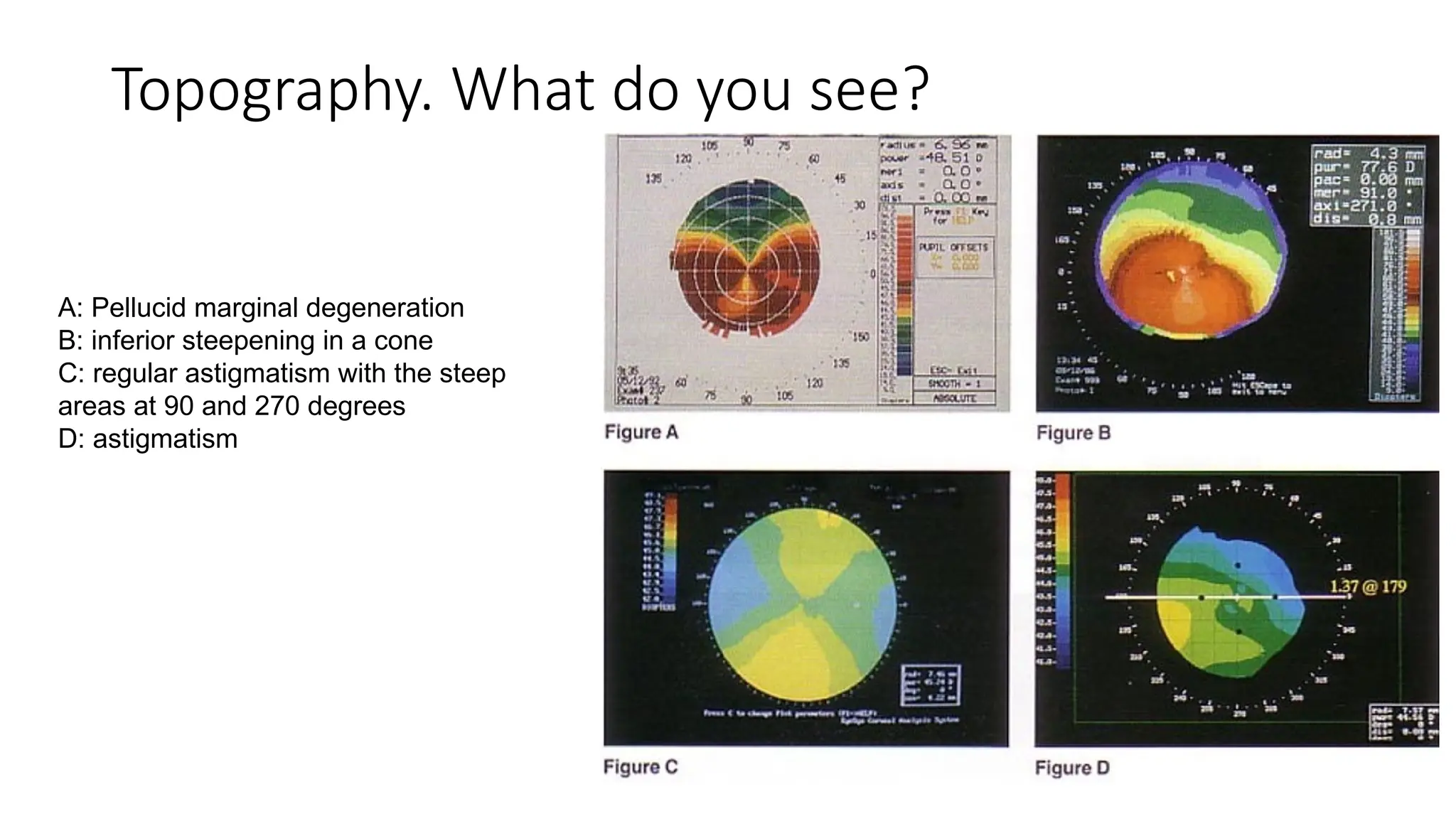 Spot Diagnosis - Look at the pictures-What do you See - Topography.pptx