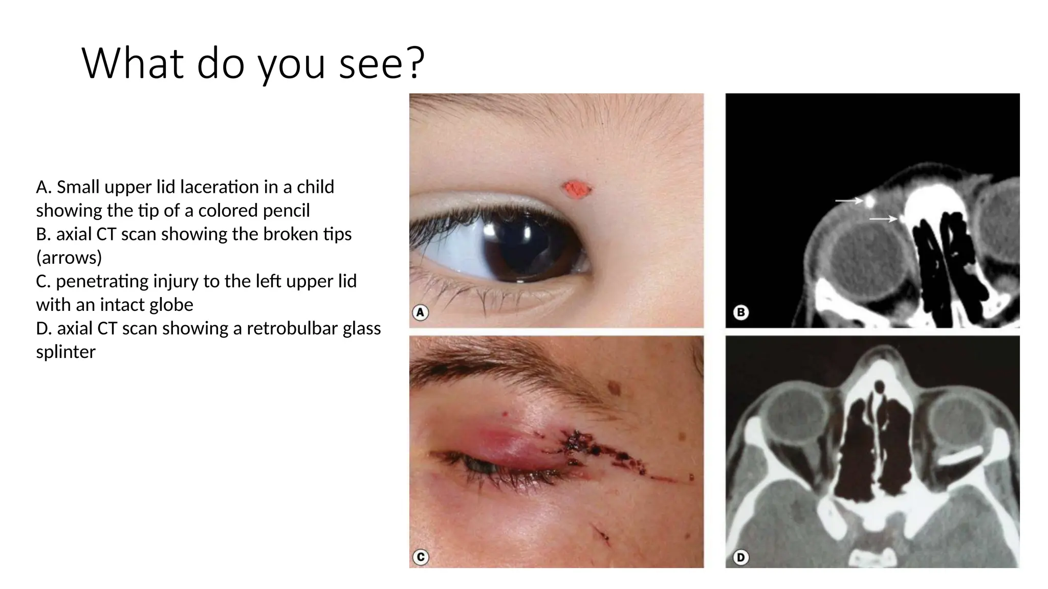 Spot Diagnosis - Look at the pictures-What do you See - Trauma.pptx