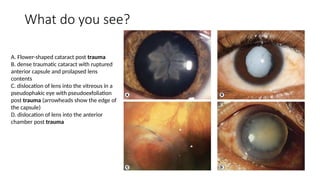 Spot Diagnosis - Look at the pictures-What do you See - Trauma.pptx