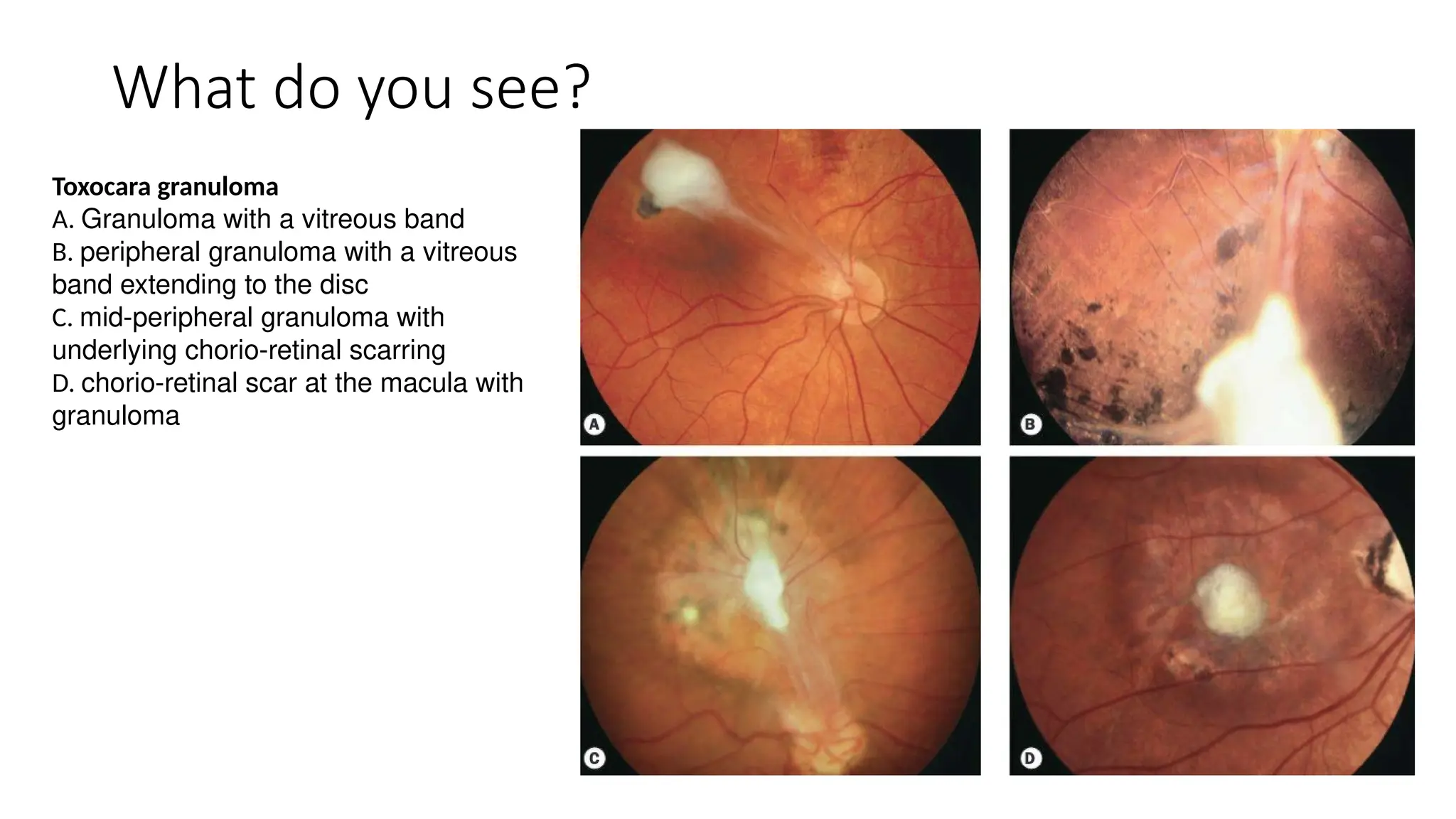 Spot Diagnosis - Look at the pictures-What do you See - Uveitis.pptx