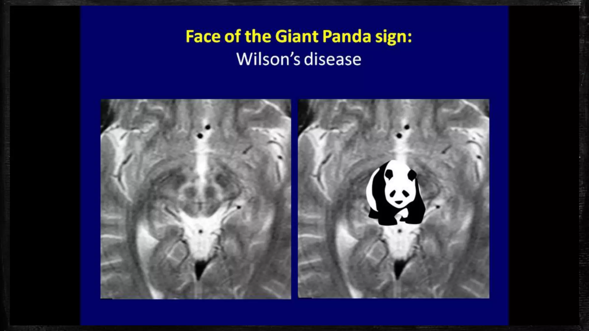 neuro radiology spotters | PPTX