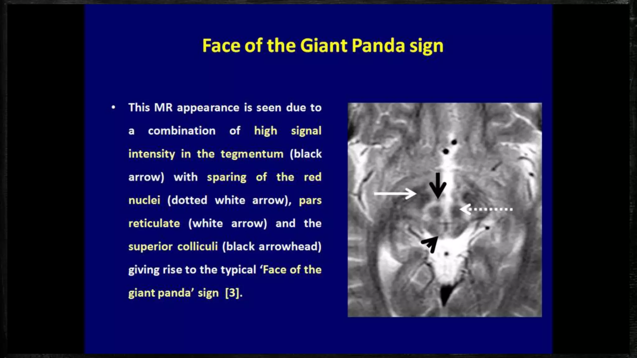 neuro radiology spotters | PPTX