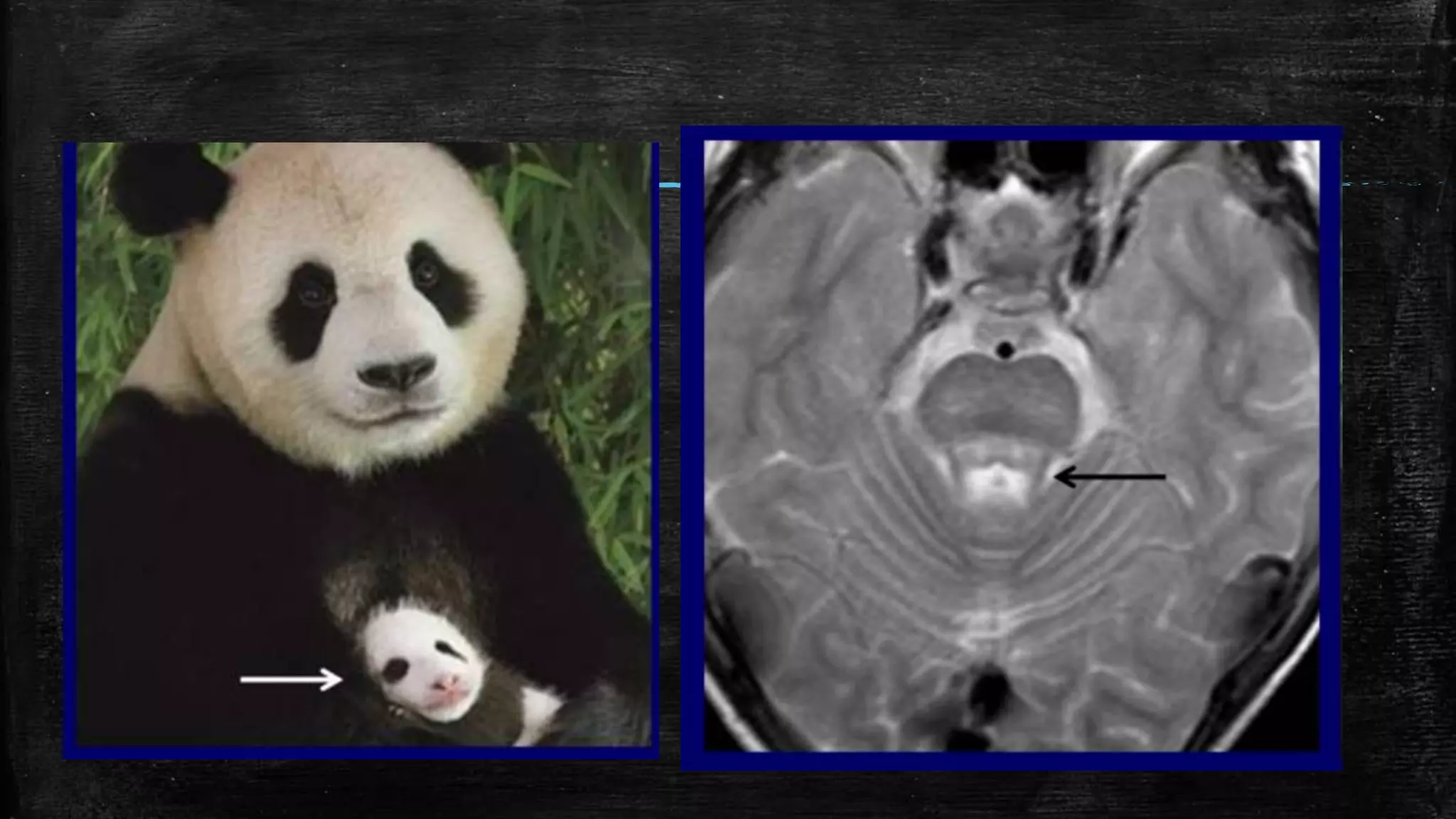 neuro radiology spotters | PPTX
