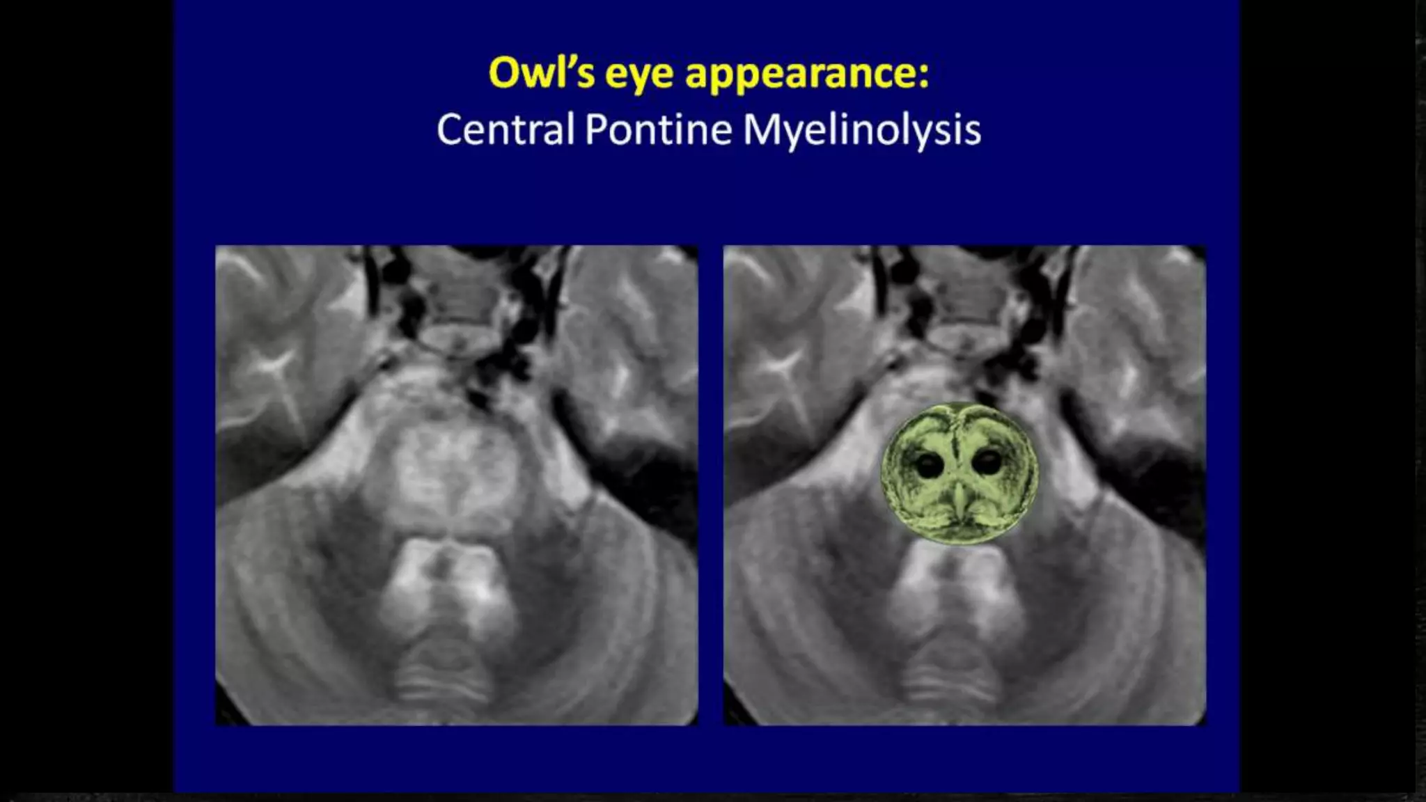 neuro radiology spotters | PPTX