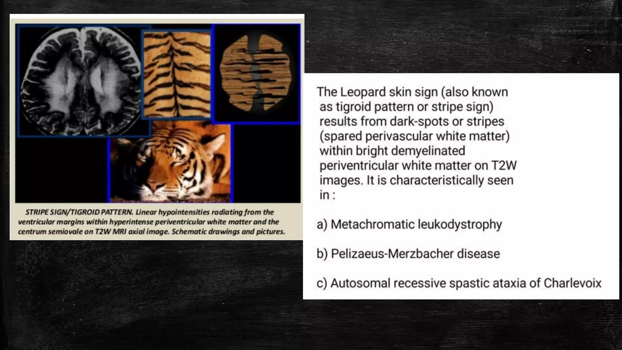 neuro radiology spotters | PPTX