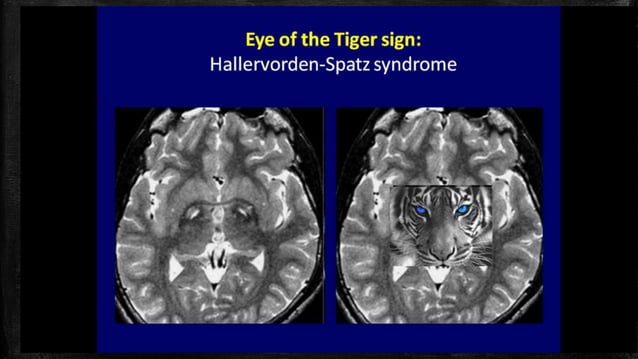 neuro radiology spotters | PPTX | Brain and Nervous System Disorders ...