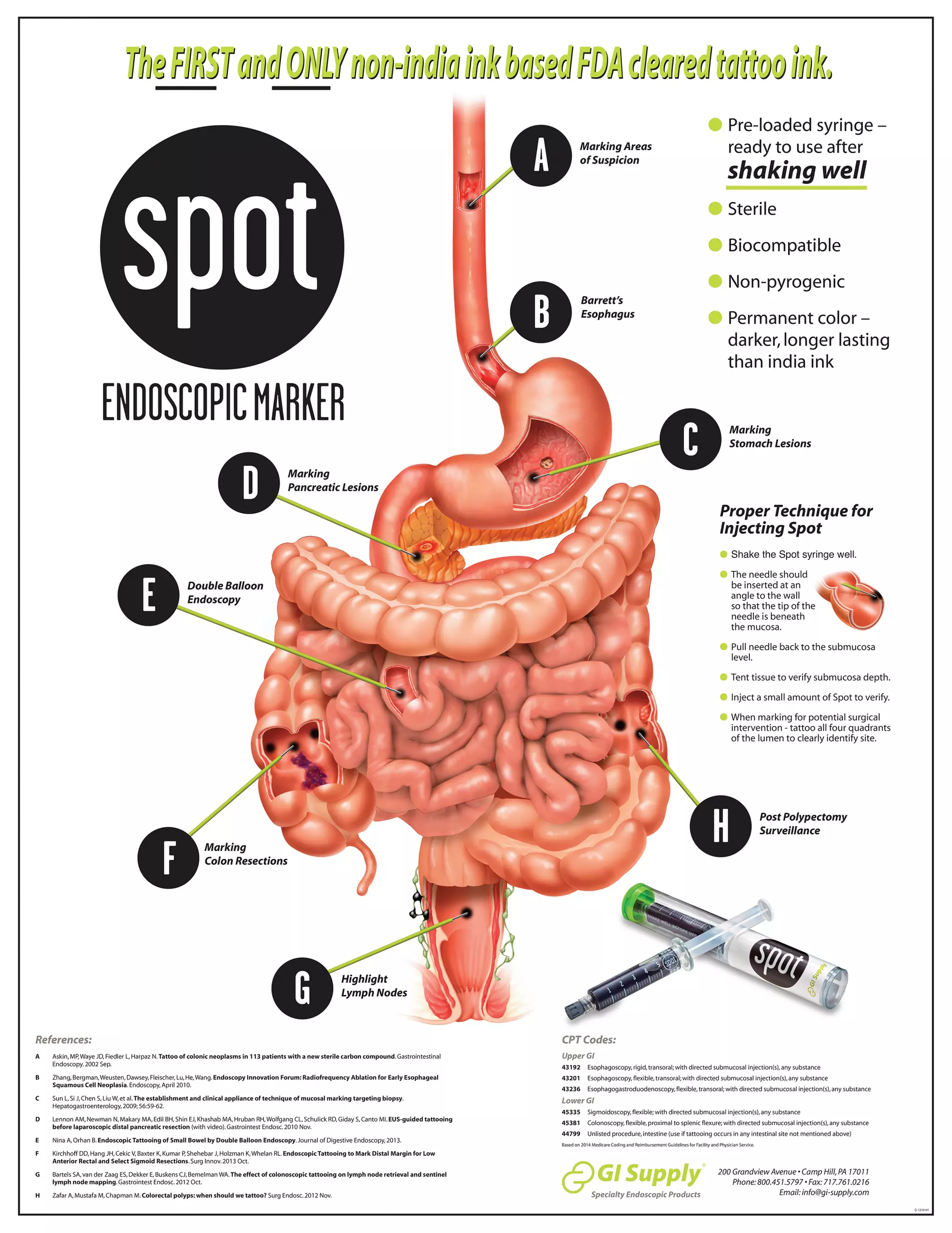 Spot Endoscopic Tattoo Poster | PDF