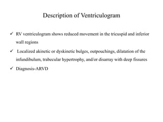 DM cardiology Exam Spotter | PPTX