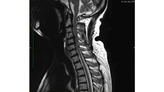 spotter.pptx | Digestive Disorders | Diseases and Conditions