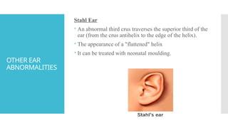 Plastic surgery spotter anotia types copy.pptx