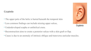 Plastic surgery spotter anotia types copy.pptx