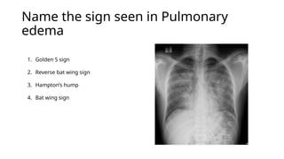 SPOTTERS 2 of musckuloskeltal system in radiology | PPTX