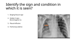 SPOTTERS 2 of musckuloskeltal system in radiology | PPTX