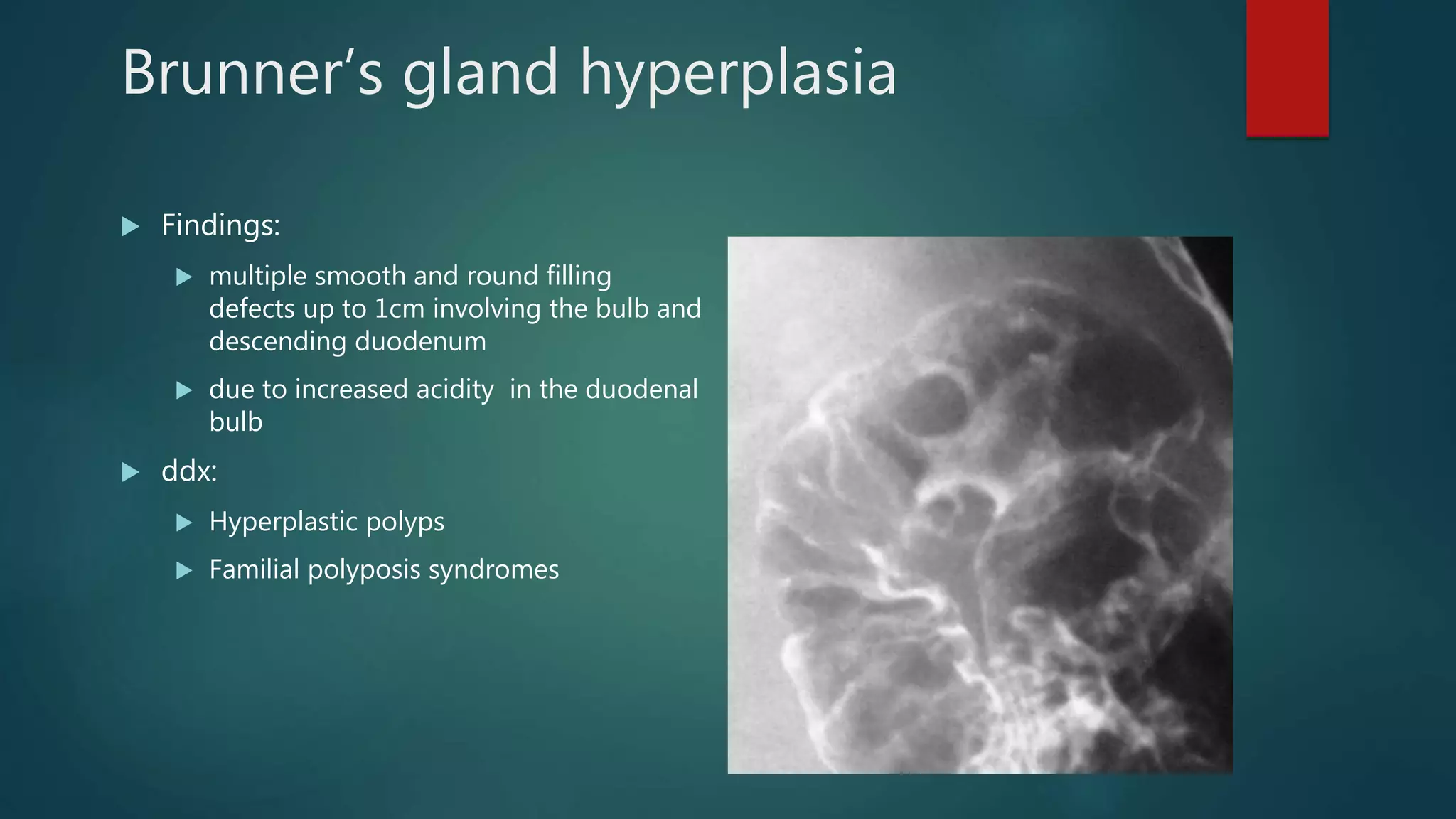 KEYS OF RADIOLOGY SPOTTERS GIT | PPTX