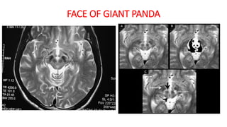 SPOTTERS IN NEUROLOGY | PPTX