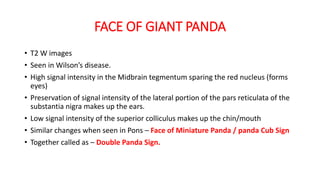 SPOTTERS IN NEUROLOGY | PPTX