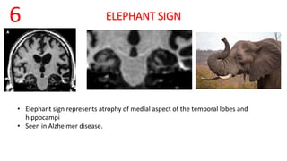 SPOTTERS IN NEUROLOGY | PPTX
