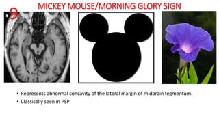SPOTTERS IN NEUROLOGY | PPTX