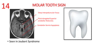 SPOTTERS IN NEUROLOGY | PPTX