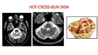 SPOTTERS IN NEUROLOGY | PPTX