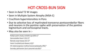 SPOTTERS IN NEUROLOGY | PPTX