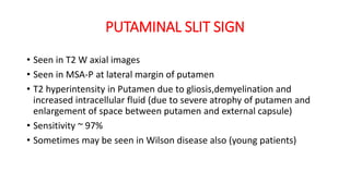 SPOTTERS IN NEUROLOGY | PPTX