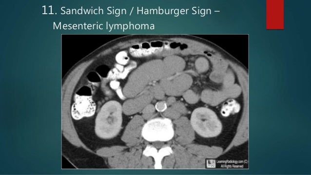 radiology Spotters mixed bag