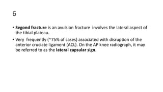 SPOTTERS in radiology with explanations | PPTX