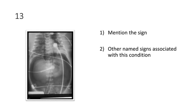 SPOTTERS in radiology with explanations | PPTX | Death, Injury, or ...