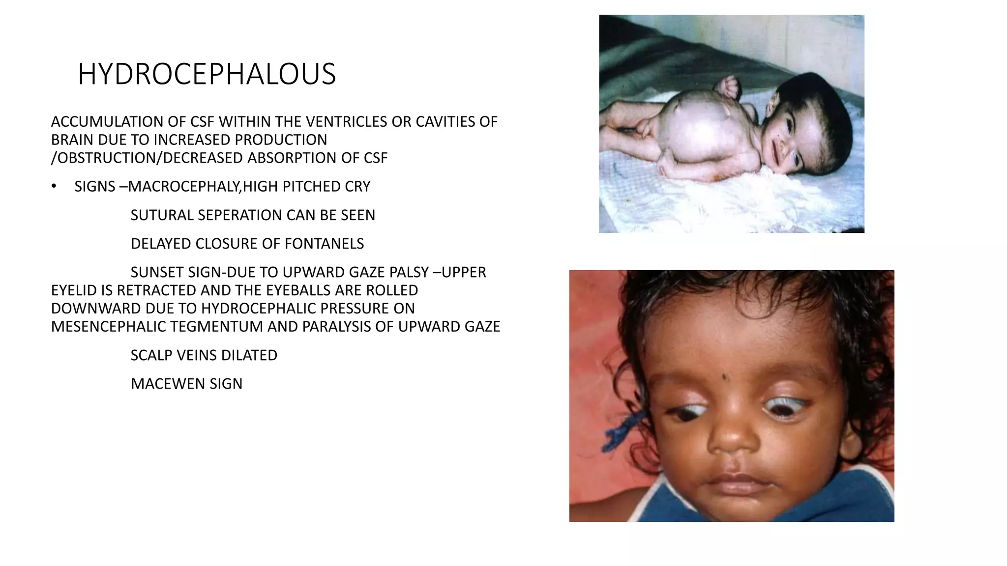 SPOTTERS REVISION.pptx