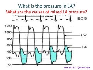 CLINICAL CLASS MD & D CARD NICVD 2017 | PPSX