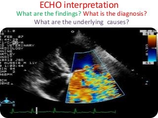 CLINICAL CLASS MD & D CARD NICVD 2017 | PPSX