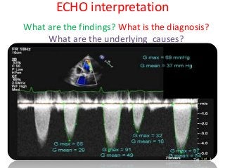 CLINICAL CLASS MD & D CARD NICVD 2017 | PPSX