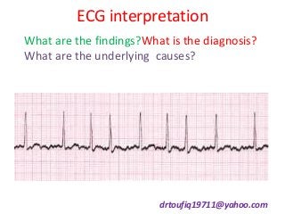 CLINICAL CLASS MD & D CARD NICVD 2017 | PPT