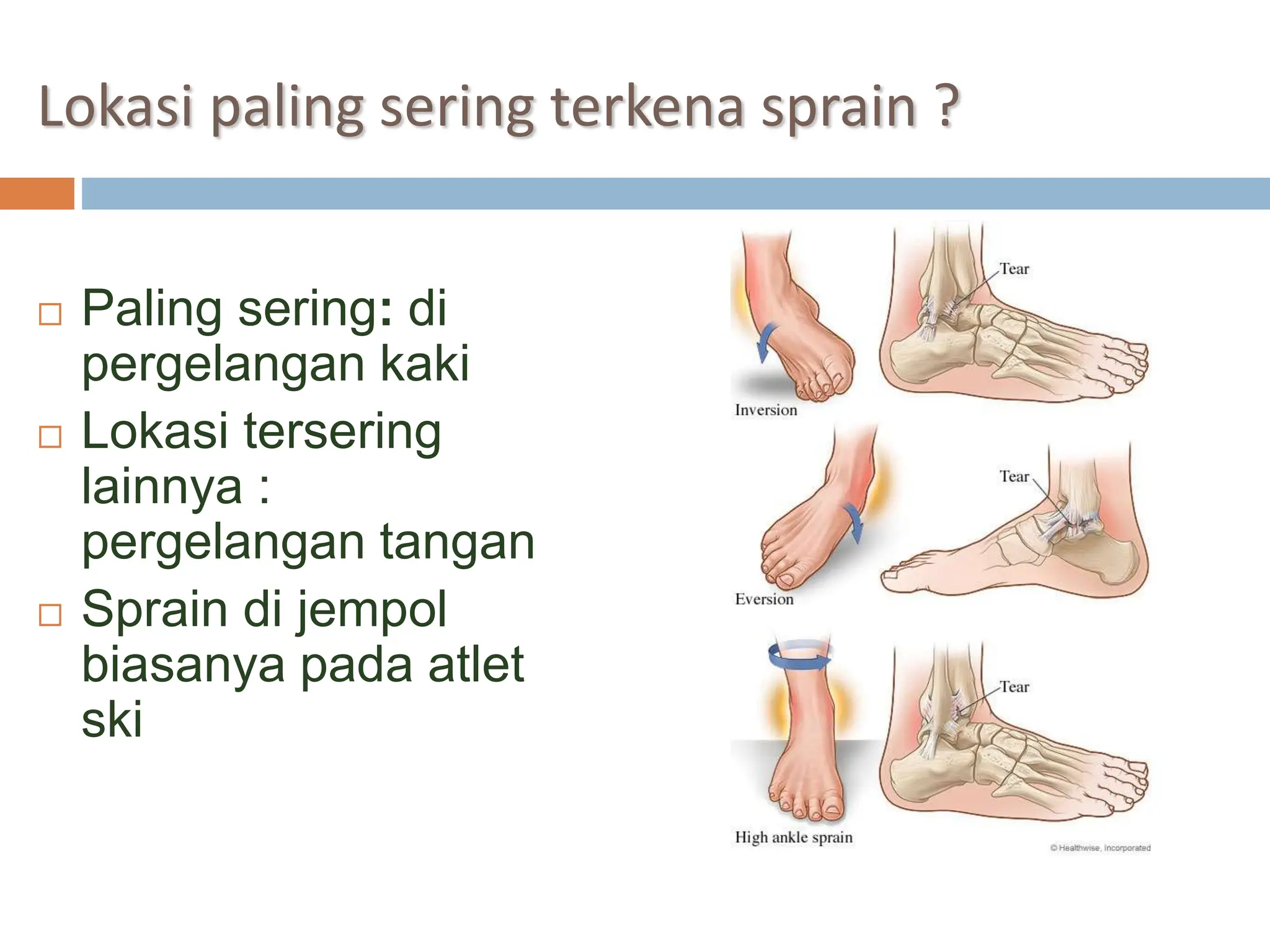 Upload a Presentation the Sprain Strain ppt | PPT