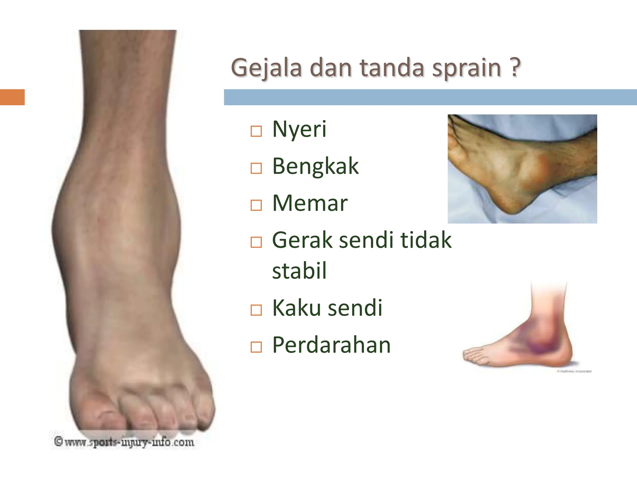 Upload a Presentation the Sprain Strain ppt | PPT